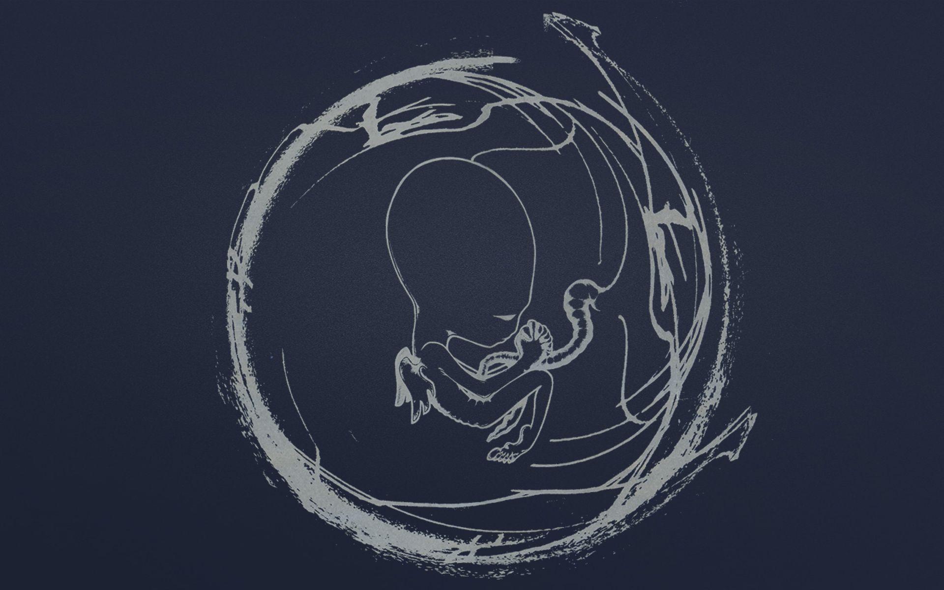 Sigur Ros Wallpapers - Top Free Sigur Ros Backgrounds - WallpaperAccess