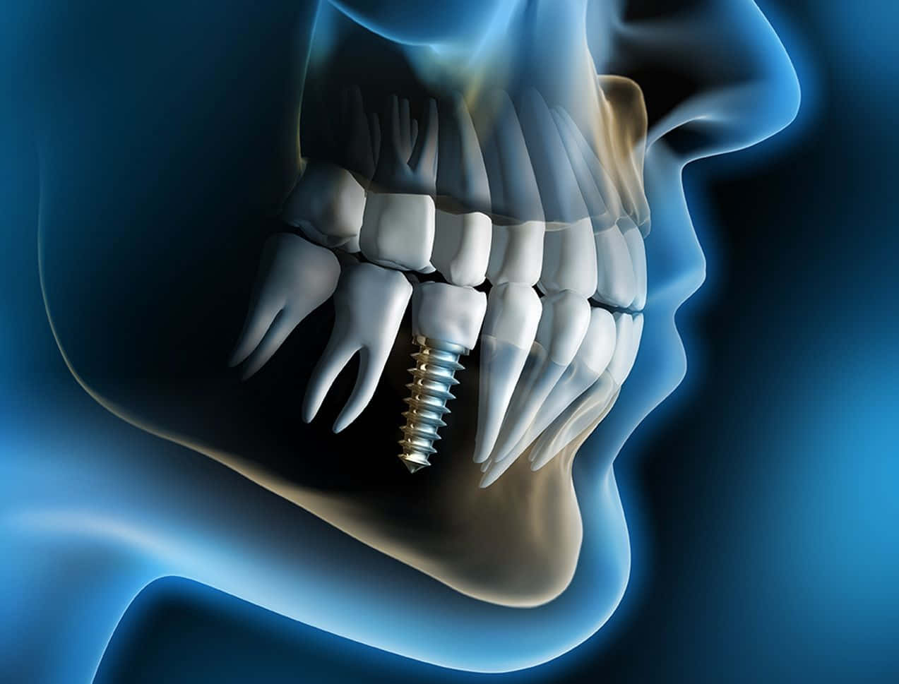 Odontology Wallpapers - Top Free Odontology Backgrounds - WallpaperAccess