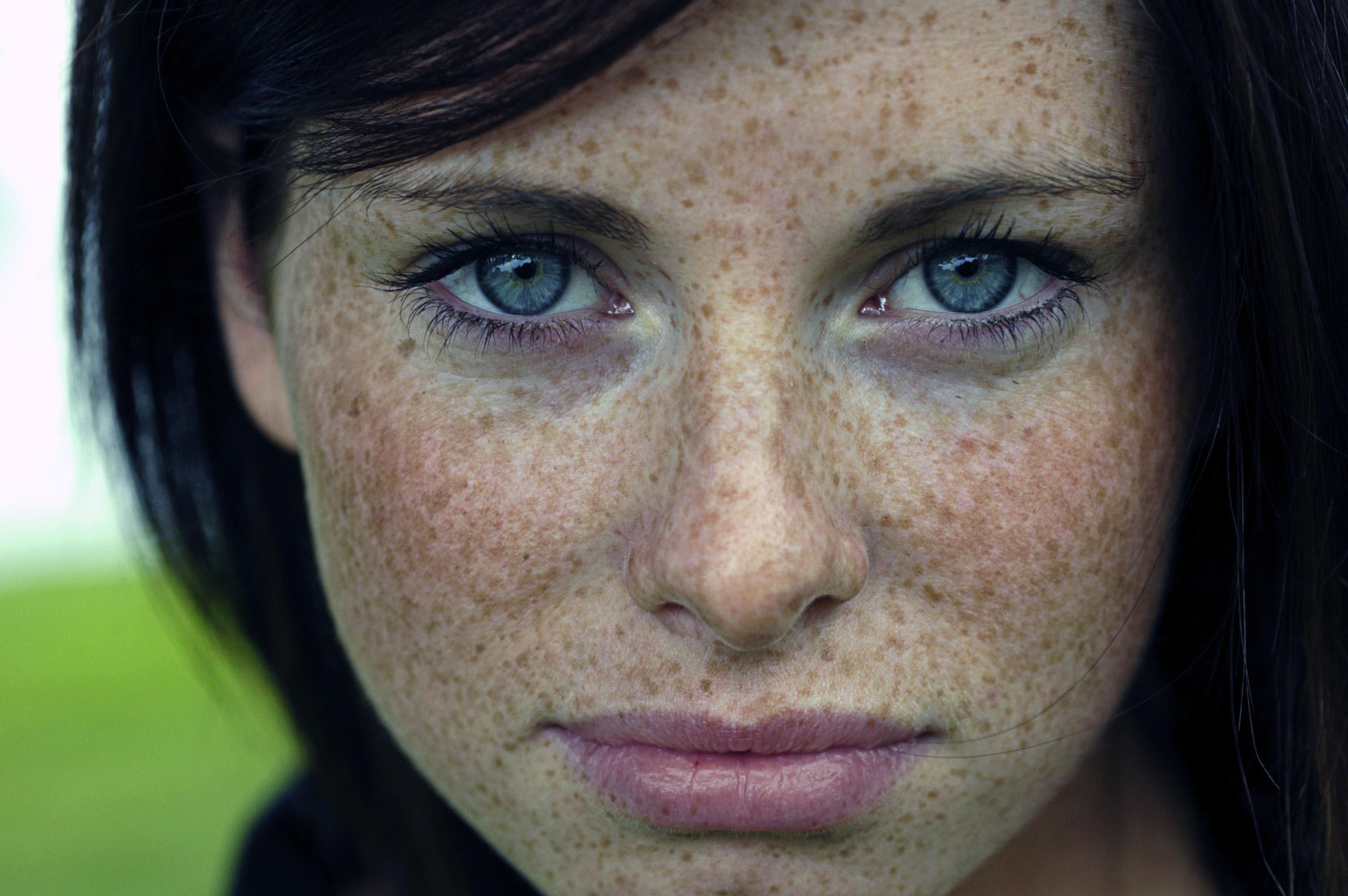 Freckles Wallpapers - Top Free Freckles Backgrounds - WallpaperAccess