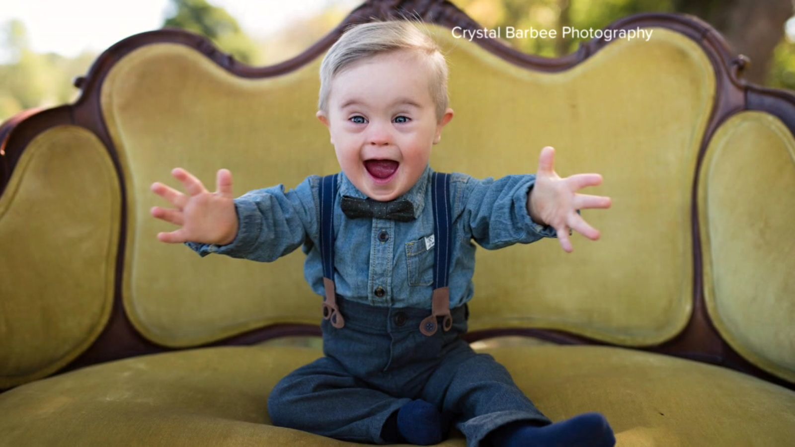 Down Syndrome Wallpapers - Top Free Down Syndrome Backgrounds ...