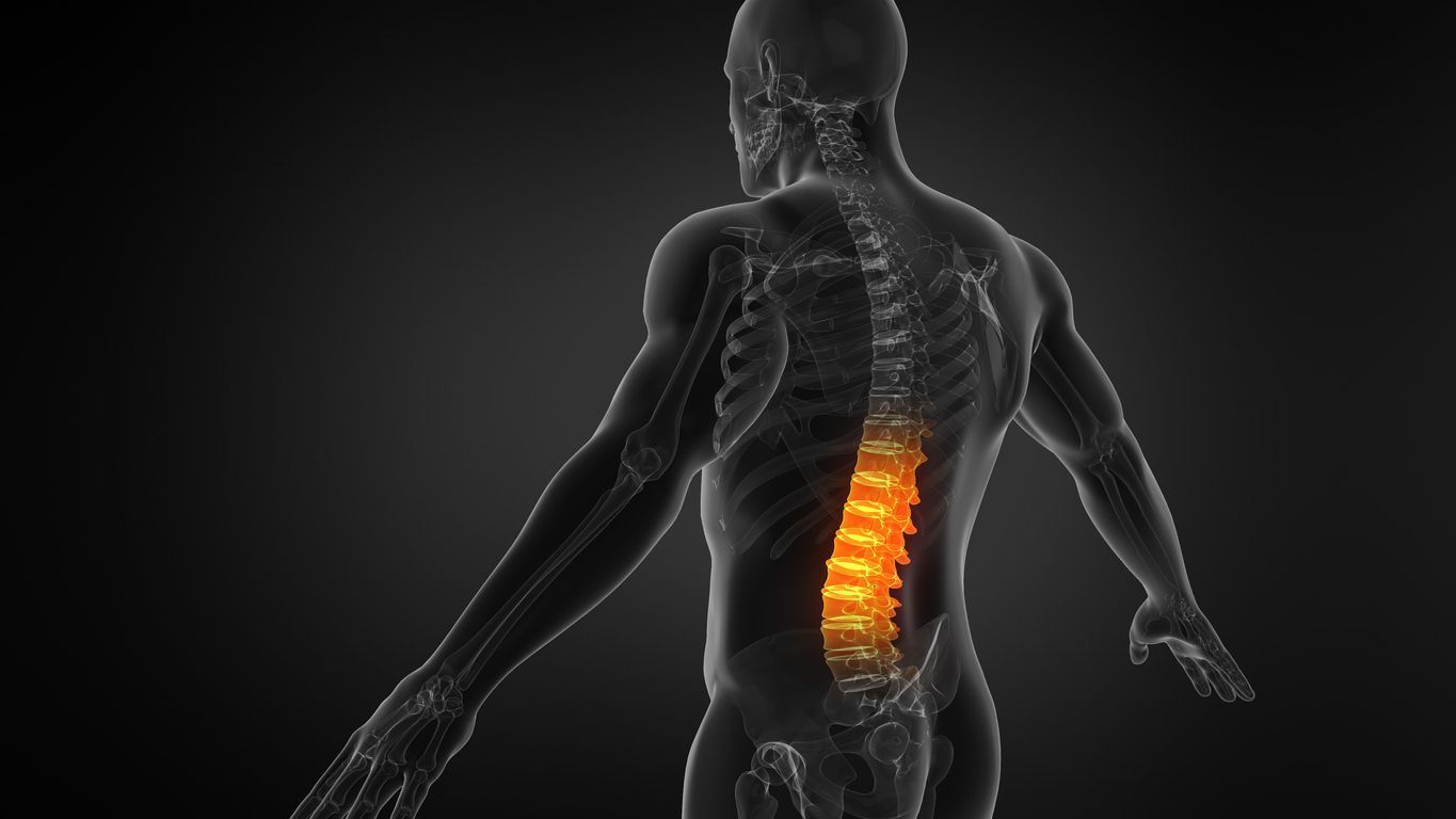 Back Pain Wallpapers - Top Free Back Pain Backgrounds - WallpaperAccess