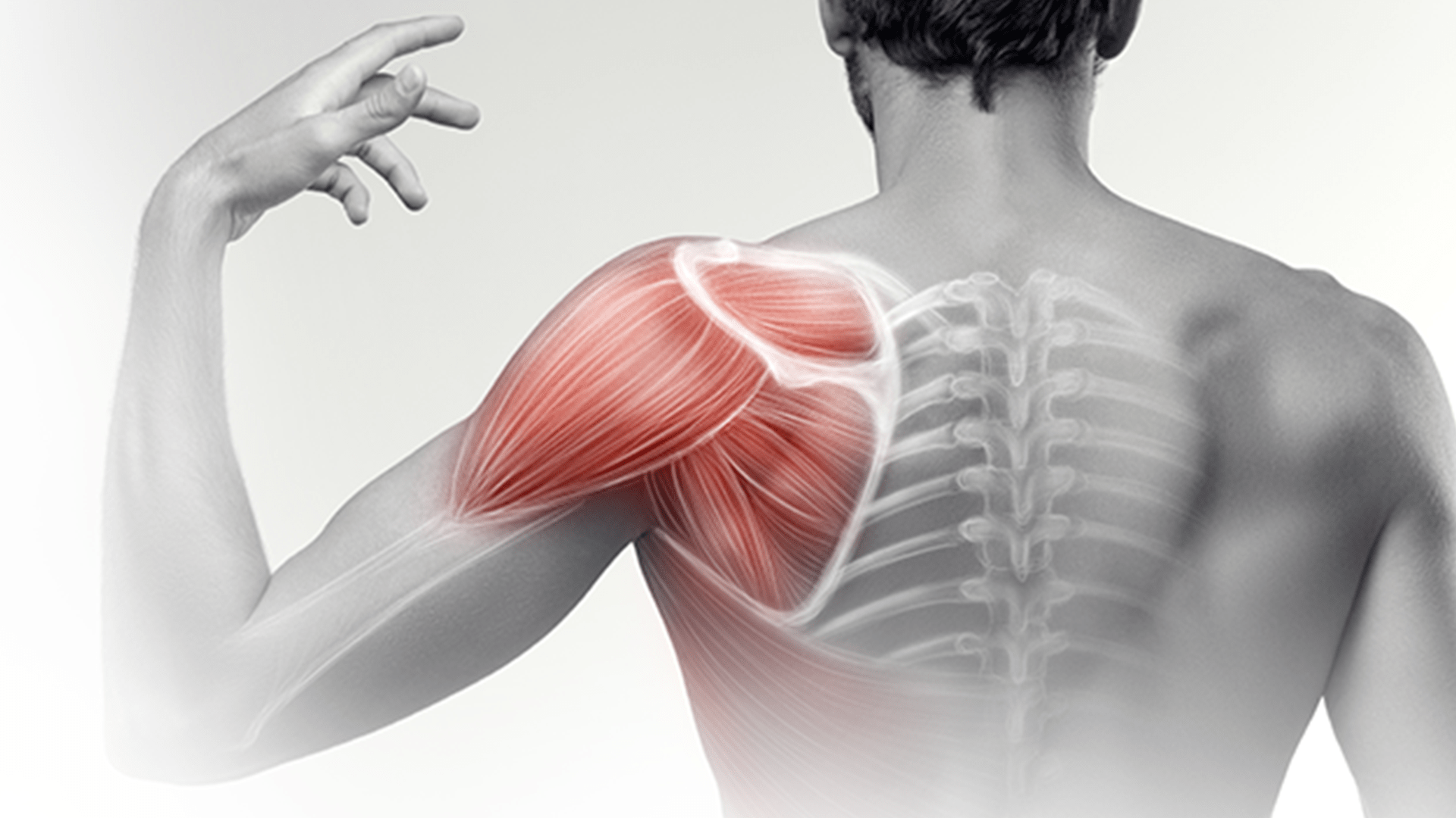 Shoulder Pain Wallpapers - Top Free Shoulder Pain Backgrounds ...