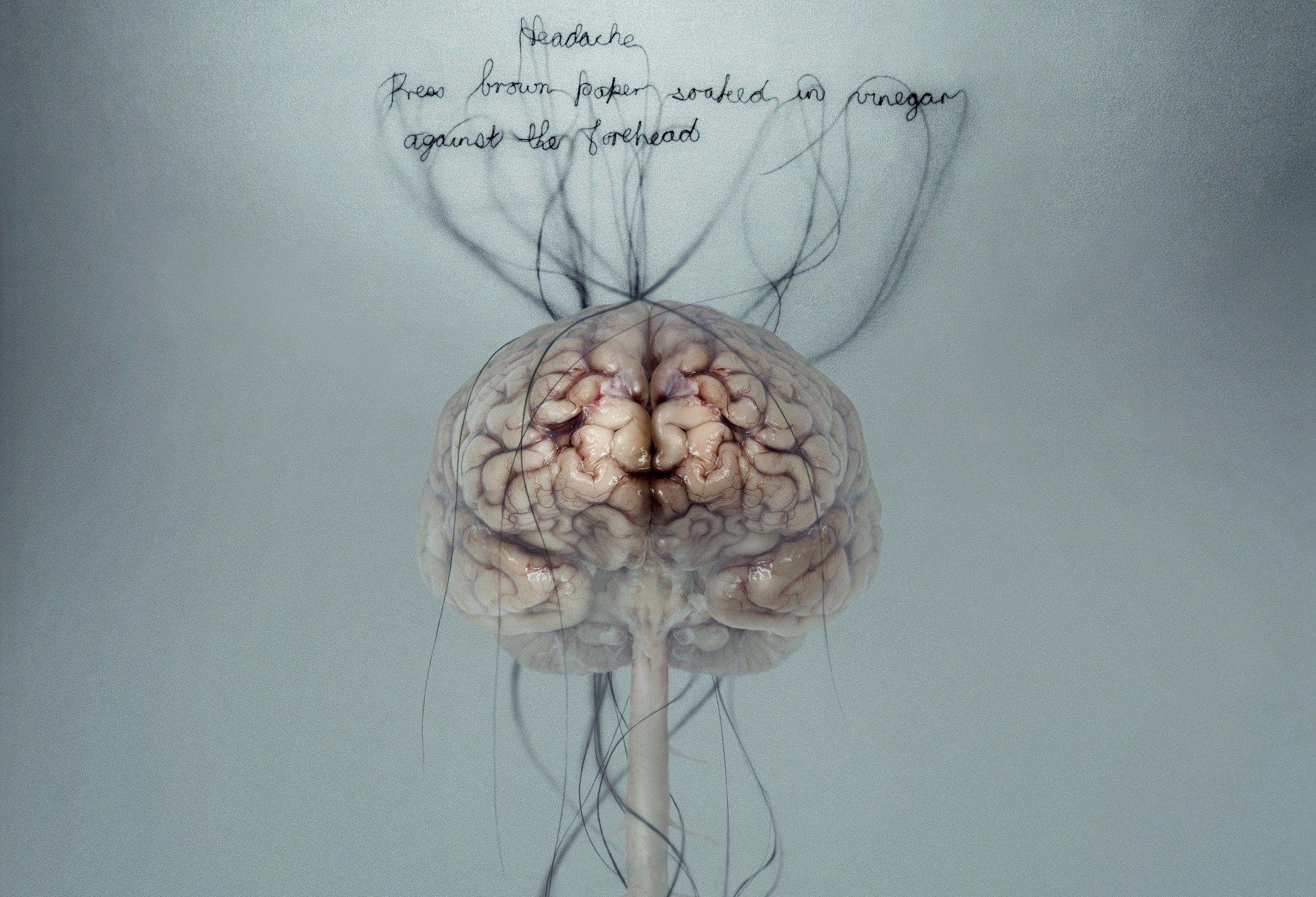 Brain Anatomy Wallpapers - Top Free Brain Anatomy Backgrounds ...