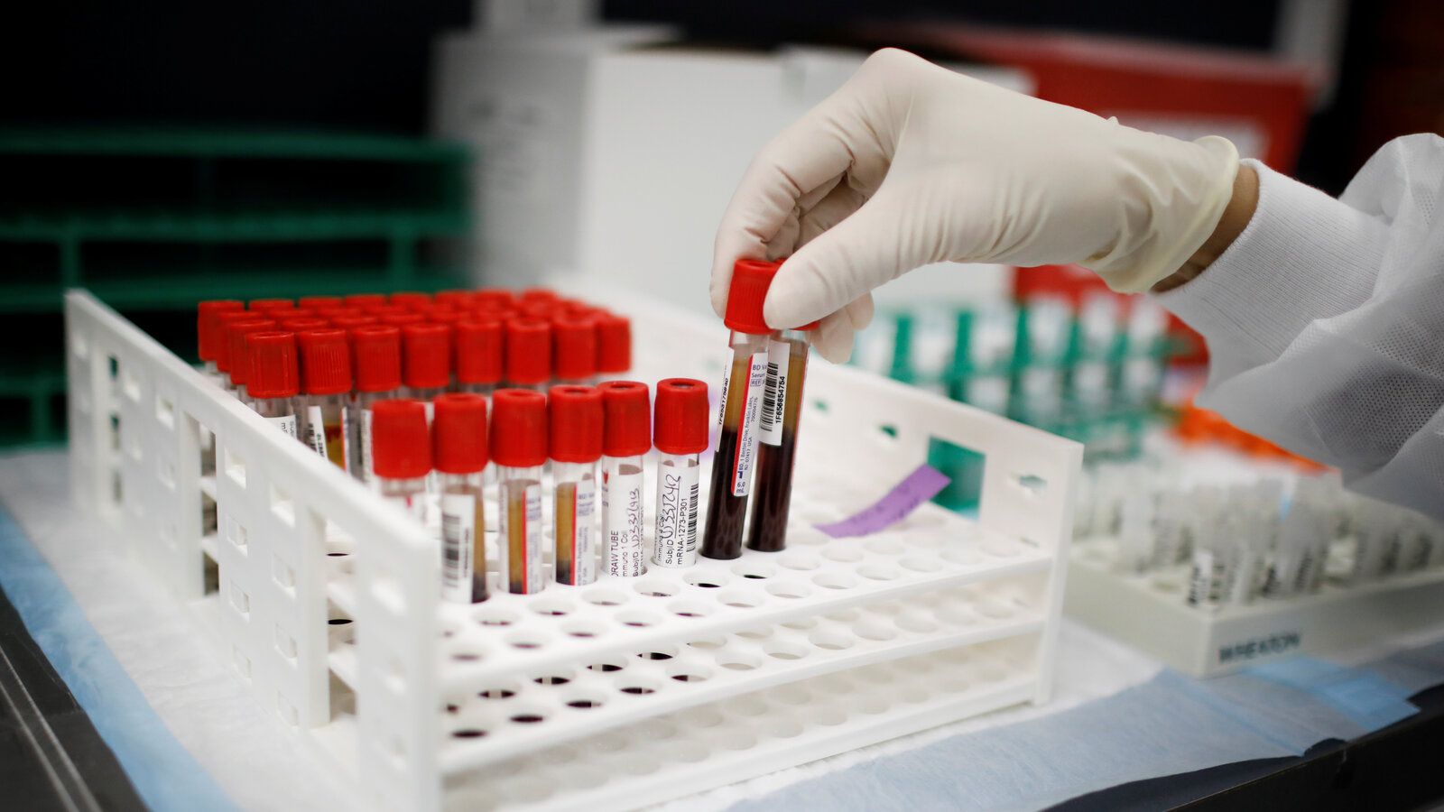 Blood Test Wallpapers - Top Free Blood Test Backgrounds - WallpaperAccess