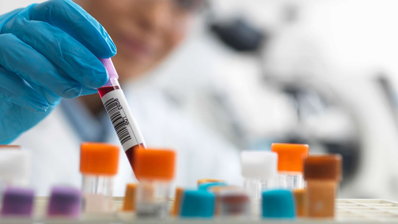 Blood Test Wallpapers - Top Free Blood Test Backgrounds - WallpaperAccess
