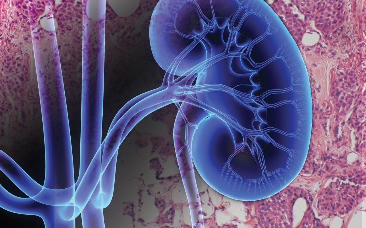 Oncology Wallpapers - Top Free Oncology Backgrounds - WallpaperAccess