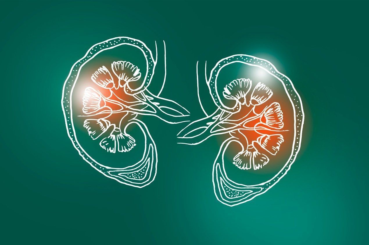 Dialysis Wallpapers - Top Free Dialysis Backgrounds - WallpaperAccess