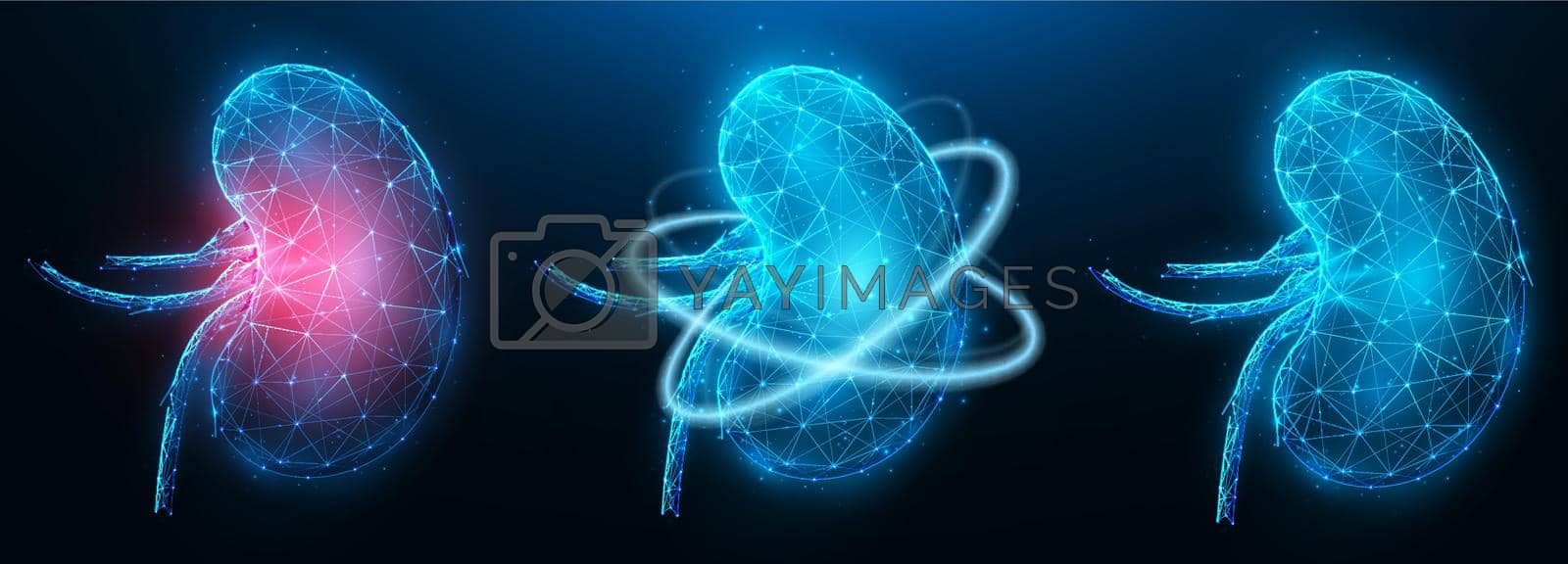 Dialysis Wallpapers - Top Free Dialysis Backgrounds - WallpaperAccess