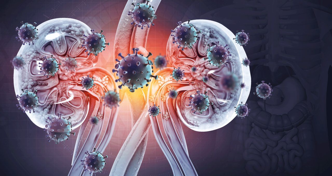 Dialysis Wallpapers - Top Free Dialysis Backgrounds - WallpaperAccess