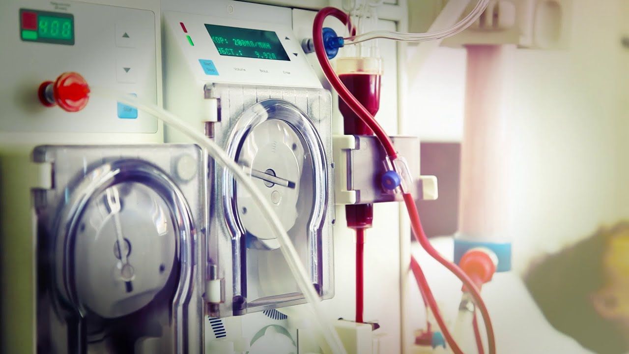 Dialysis Wallpapers - Top Free Dialysis Backgrounds - WallpaperAccess