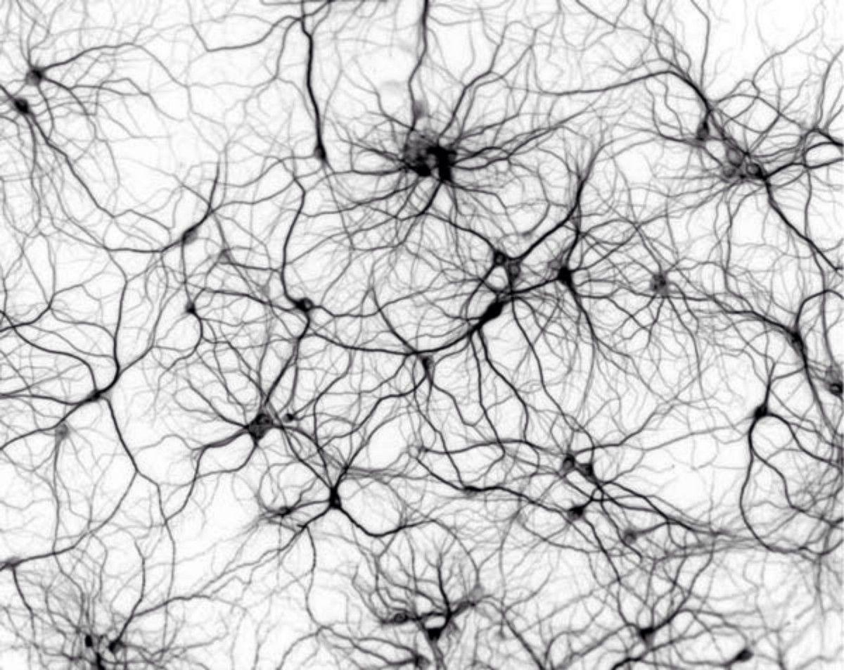 Neuron Wallpapers - Top Free Neuron Backgrounds - WallpaperAccess