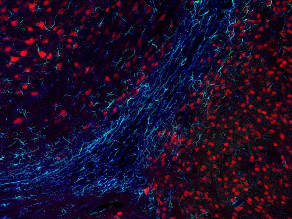 Neuro Wallpapers - Top Free Neuro Backgrounds - WallpaperAccess