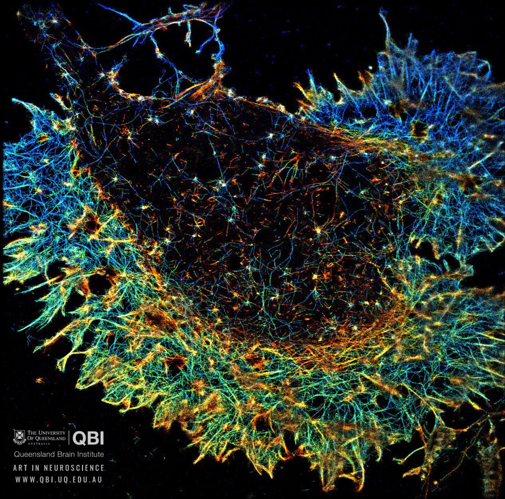 Neurology Wallpapers - Top Free Neurology Backgrounds - WallpaperAccess