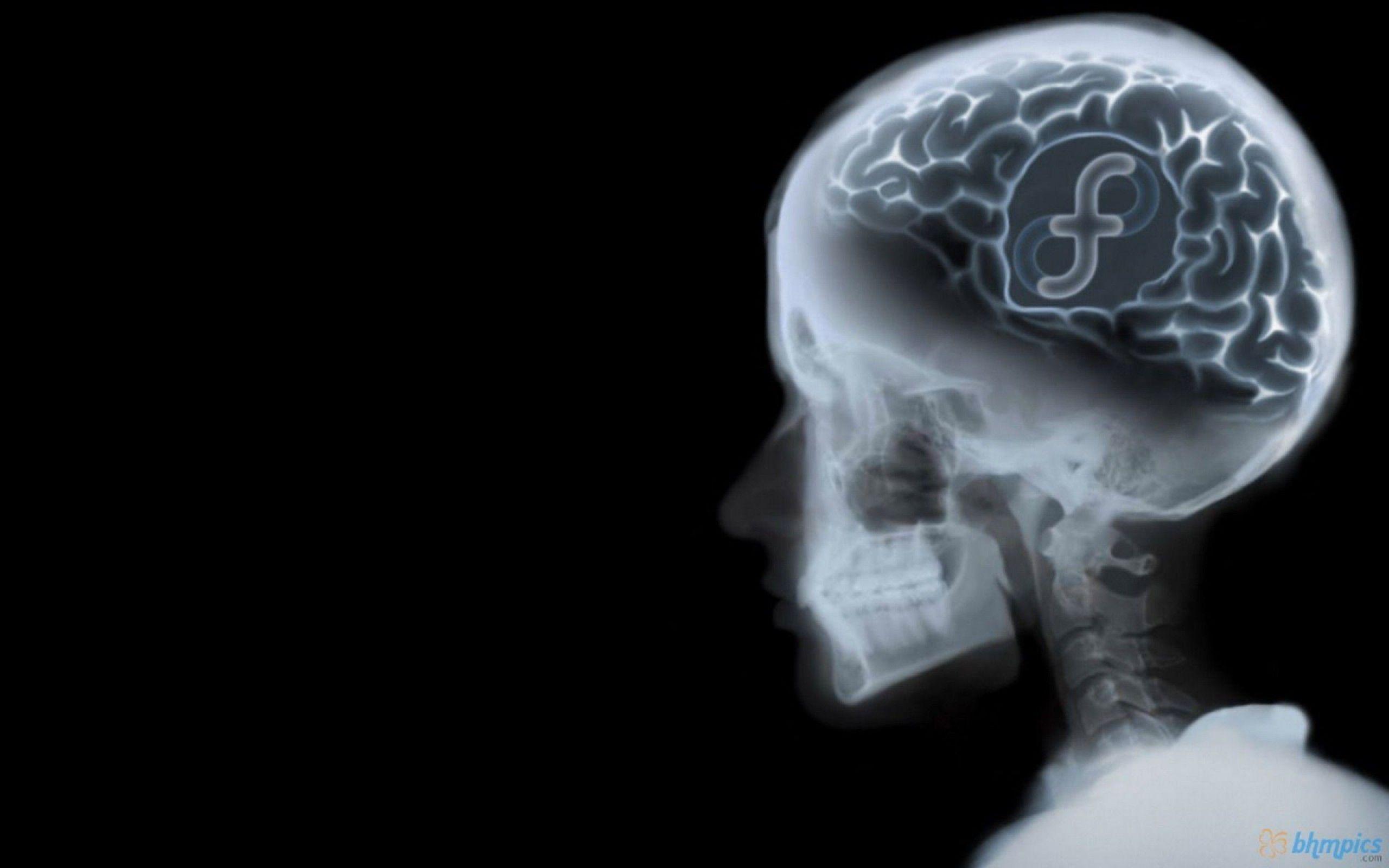 Radiology Wallpapers - Top Free Radiology Backgrounds - WallpaperAccess