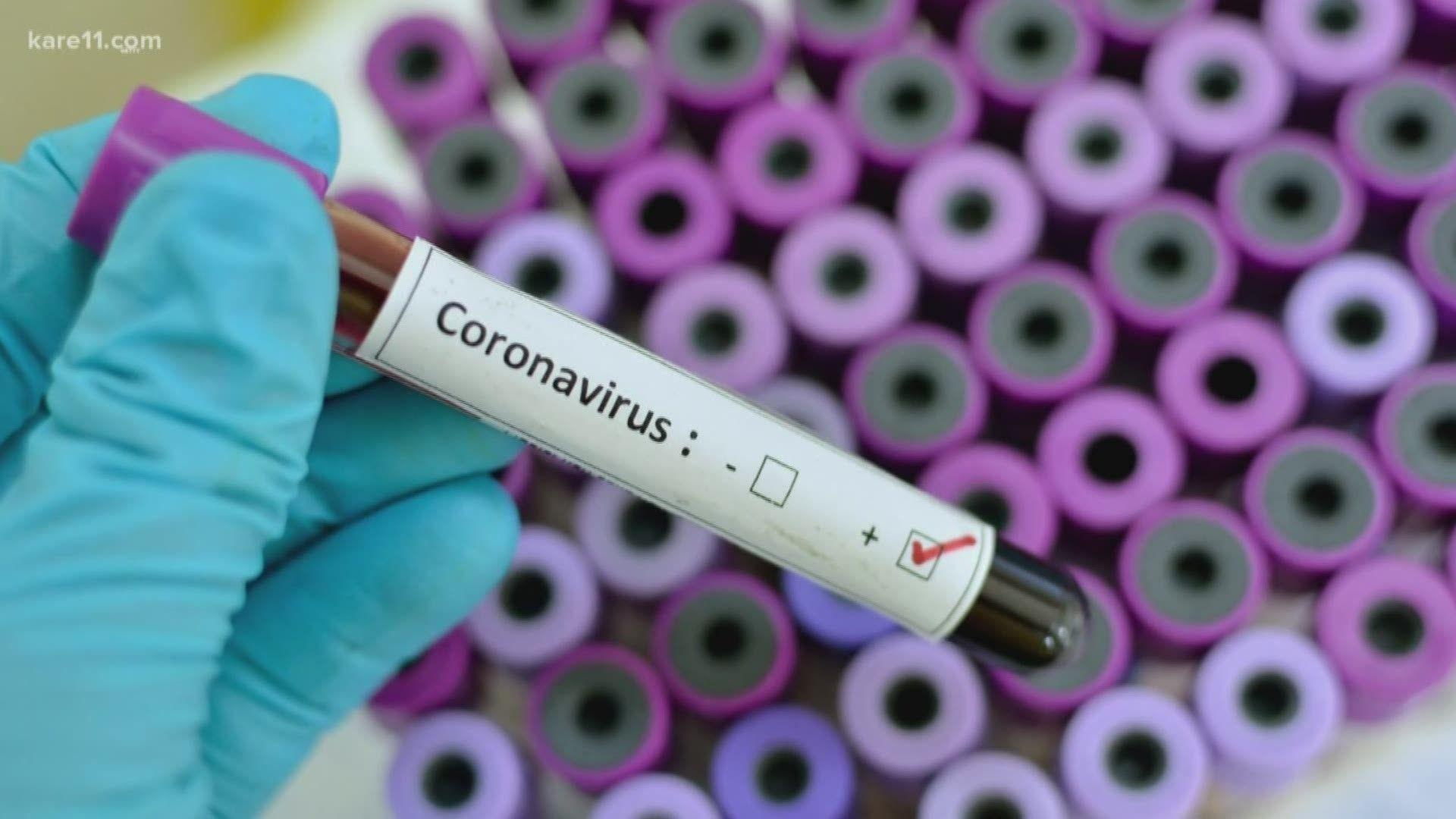 Coronavirus HD Wallpapers - Top Free Coronavirus HD Backgrounds ...