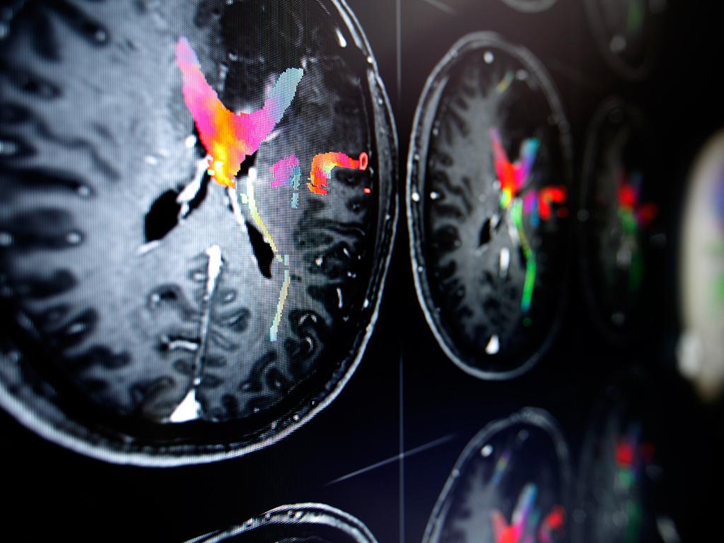 Neurosurgeon Wallpapers - Top Free Neurosurgeon Backgrounds ...