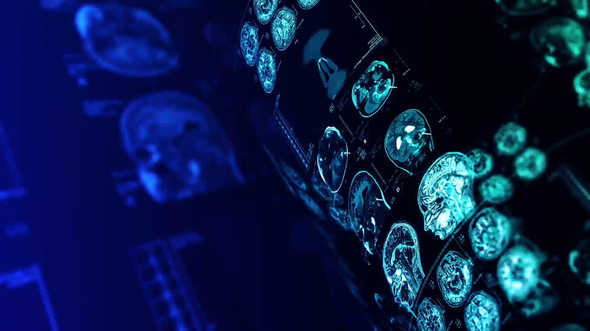 Neurosurgeon Wallpapers - Top Free Neurosurgeon Backgrounds ...