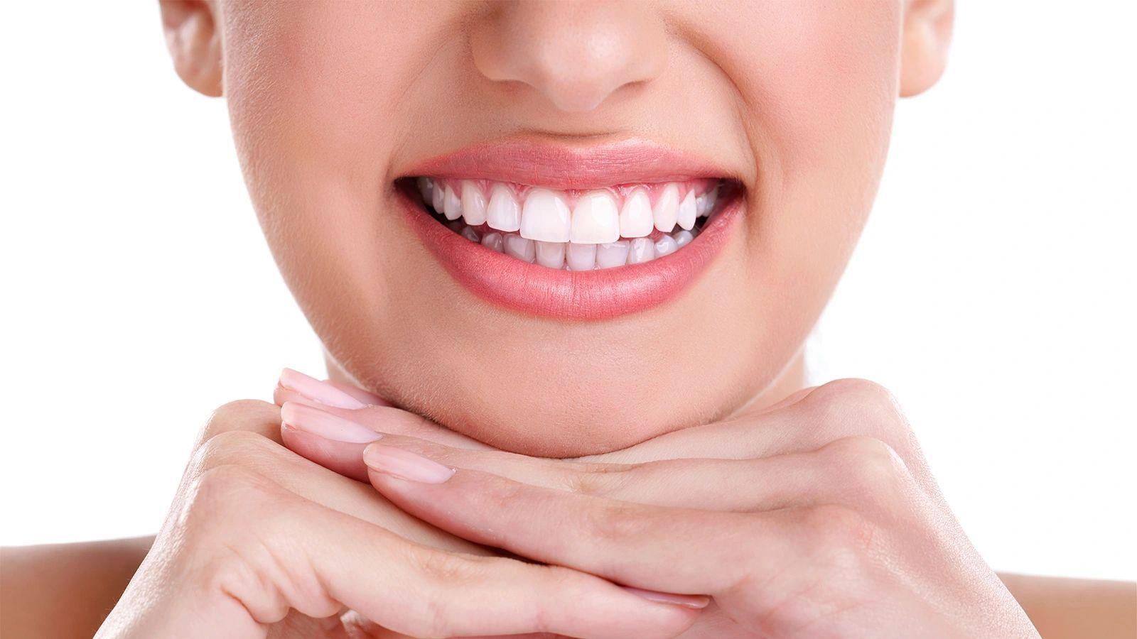 Smile Dental Wallpapers - Top Free Smile Dental Backgrounds ...