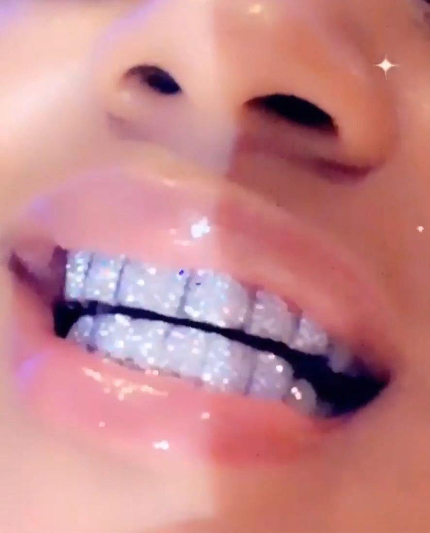 Gold Teeth Wallpapers - Top Free Gold Teeth Backgrounds - WallpaperAccess