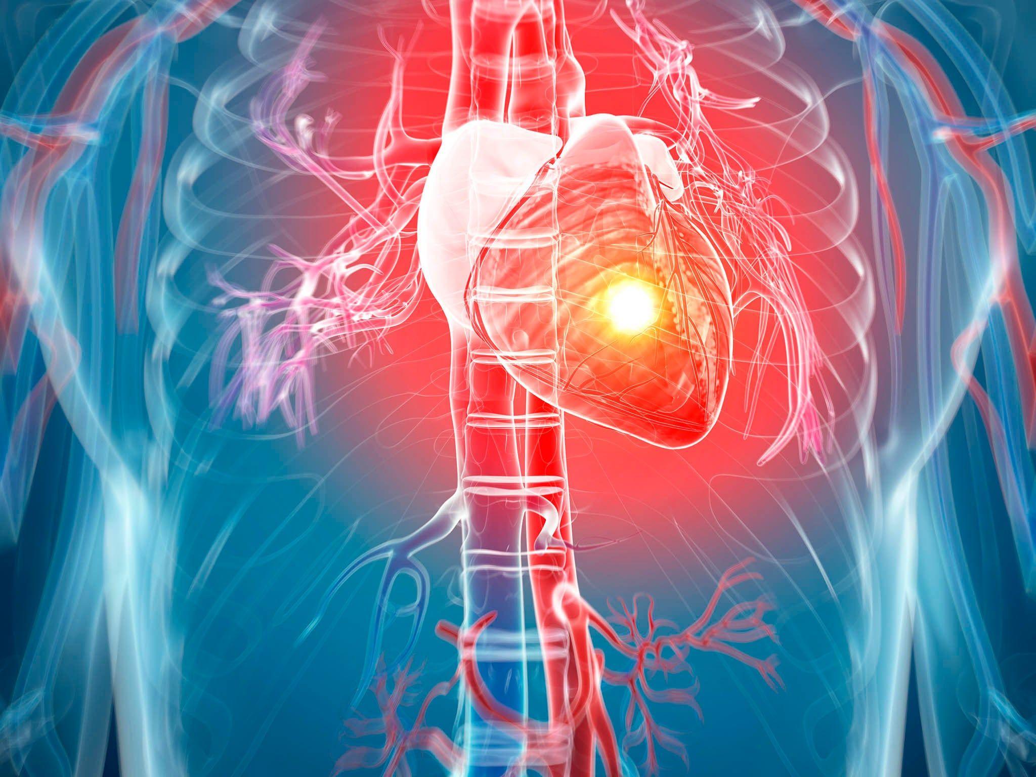 Heart Attack Wallpapers - Top Free Heart Attack Backgrounds - WallpaperAccess