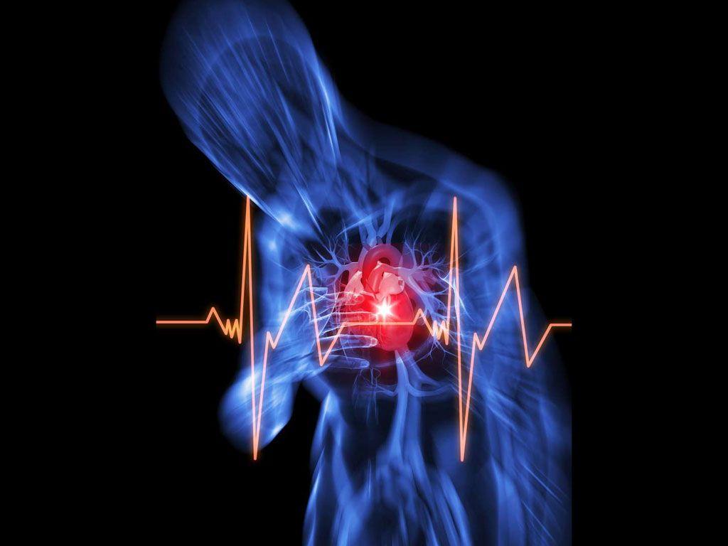 Heart Attack Wallpapers - Top Free Heart Attack Backgrounds ...
