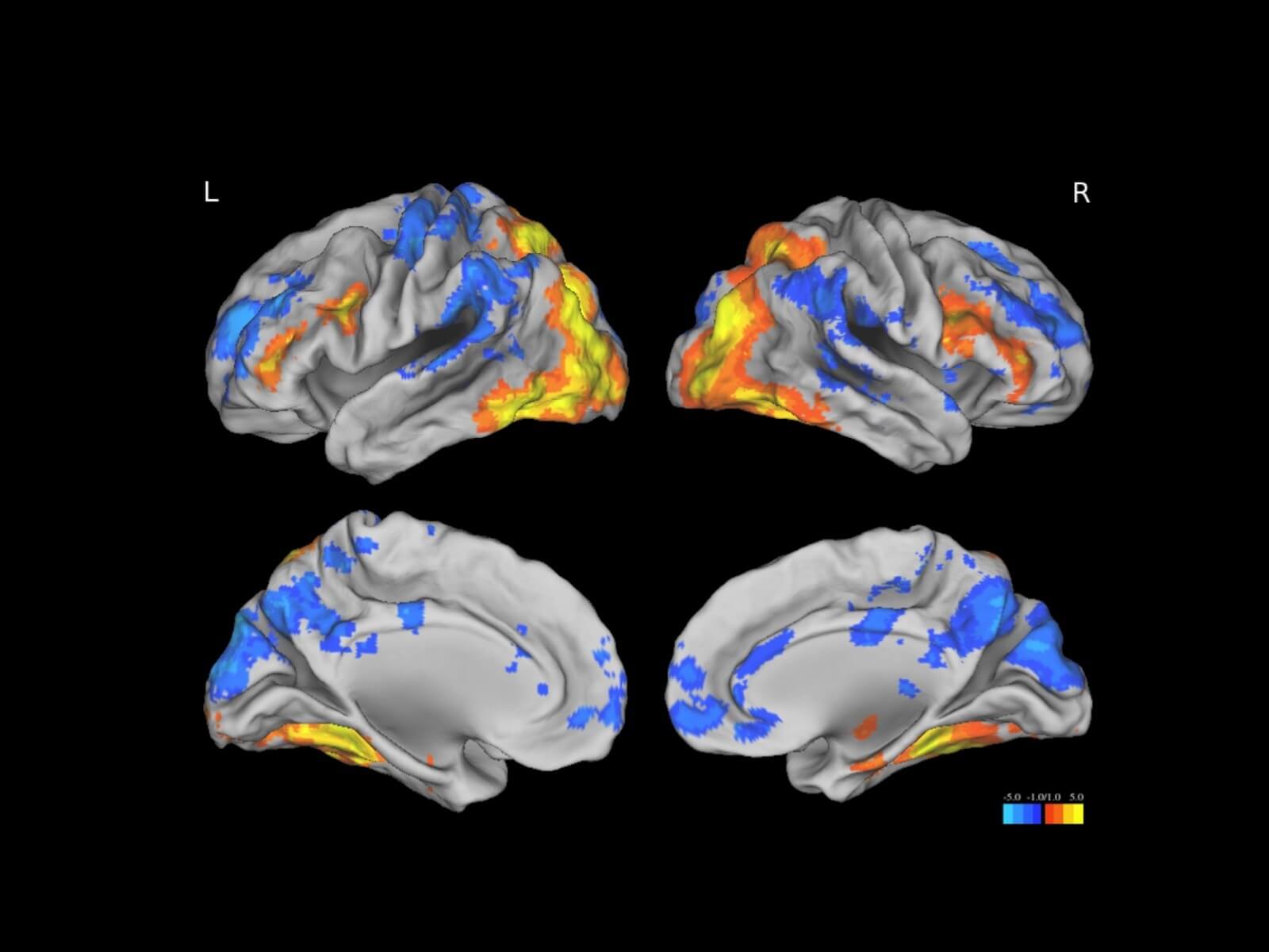 Neurology Wallpapers - Top Free Neurology Backgrounds - WallpaperAccess