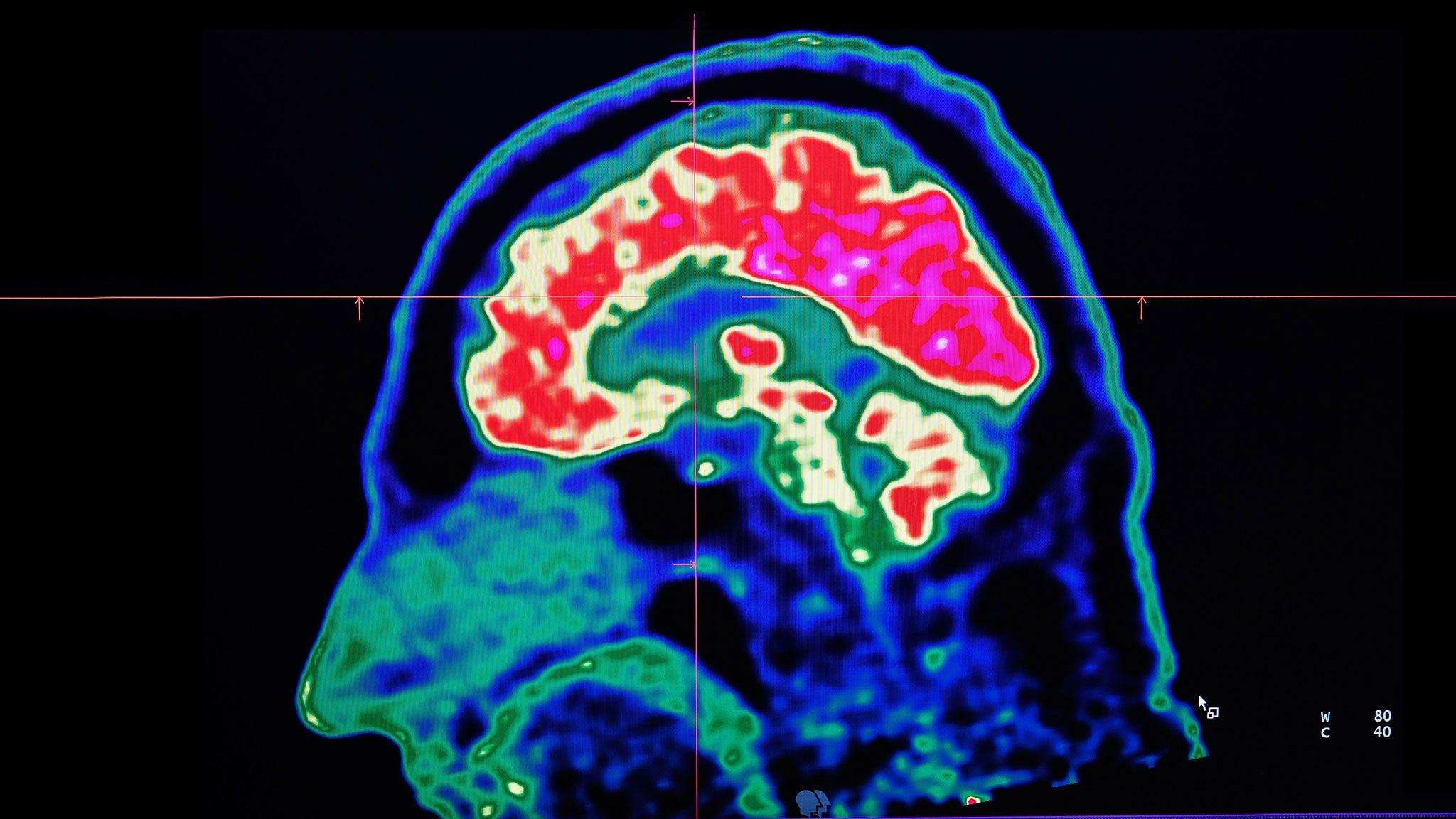 Neuralink Wallpapers - Top Free Neuralink Backgrounds - WallpaperAccess