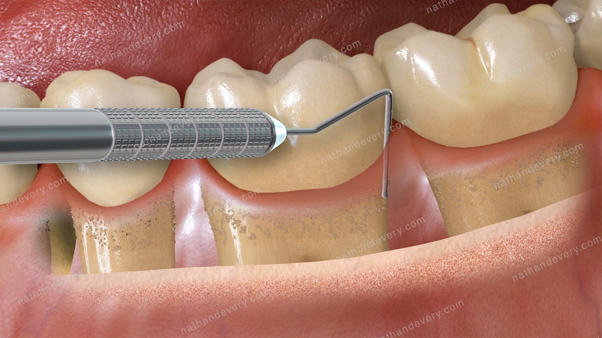 Orthodontic Wallpapers - Top Free Orthodontic Backgrounds - WallpaperAccess