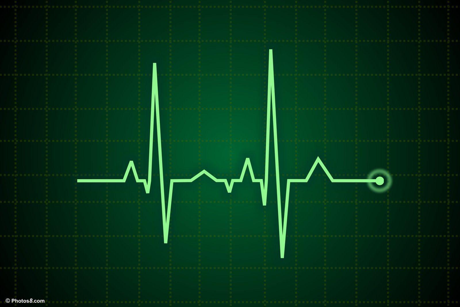 Heart Monitor Flatline Wallpapers - Top Free Heart Monitor Flatline ...