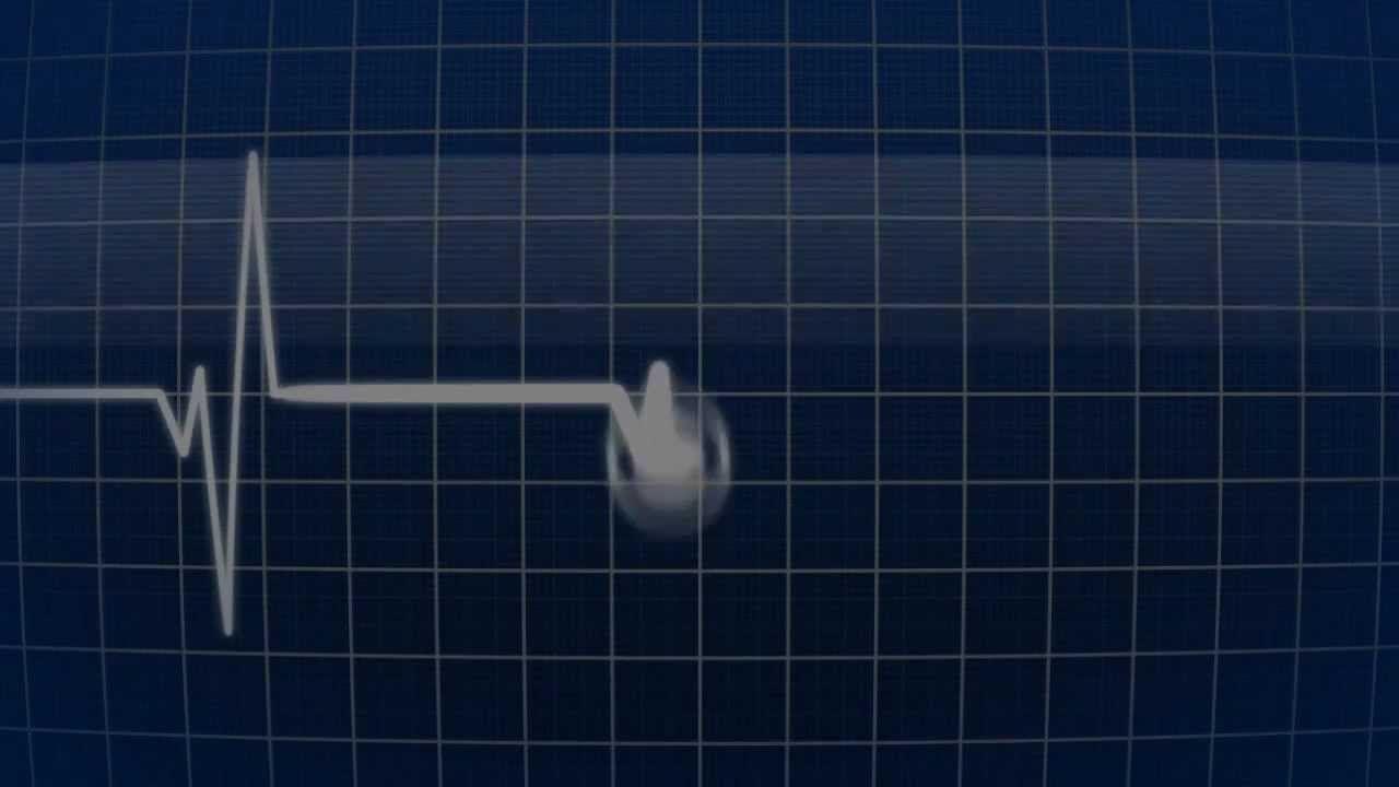 Heart Monitor Flatline Wallpapers - Top Free Heart Monitor Flatline ...