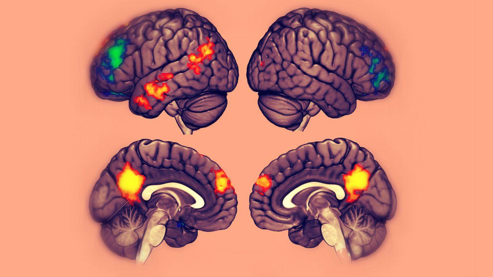 Psychology Brain HD Wallpapers - Top Free Psychology Brain HD ...