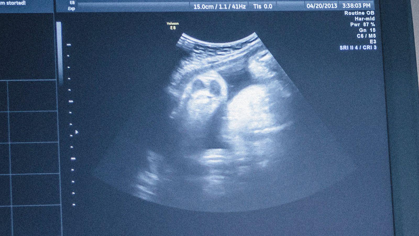 Ultrasound Wallpapers - Top Free Ultrasound Backgrounds - WallpaperAccess