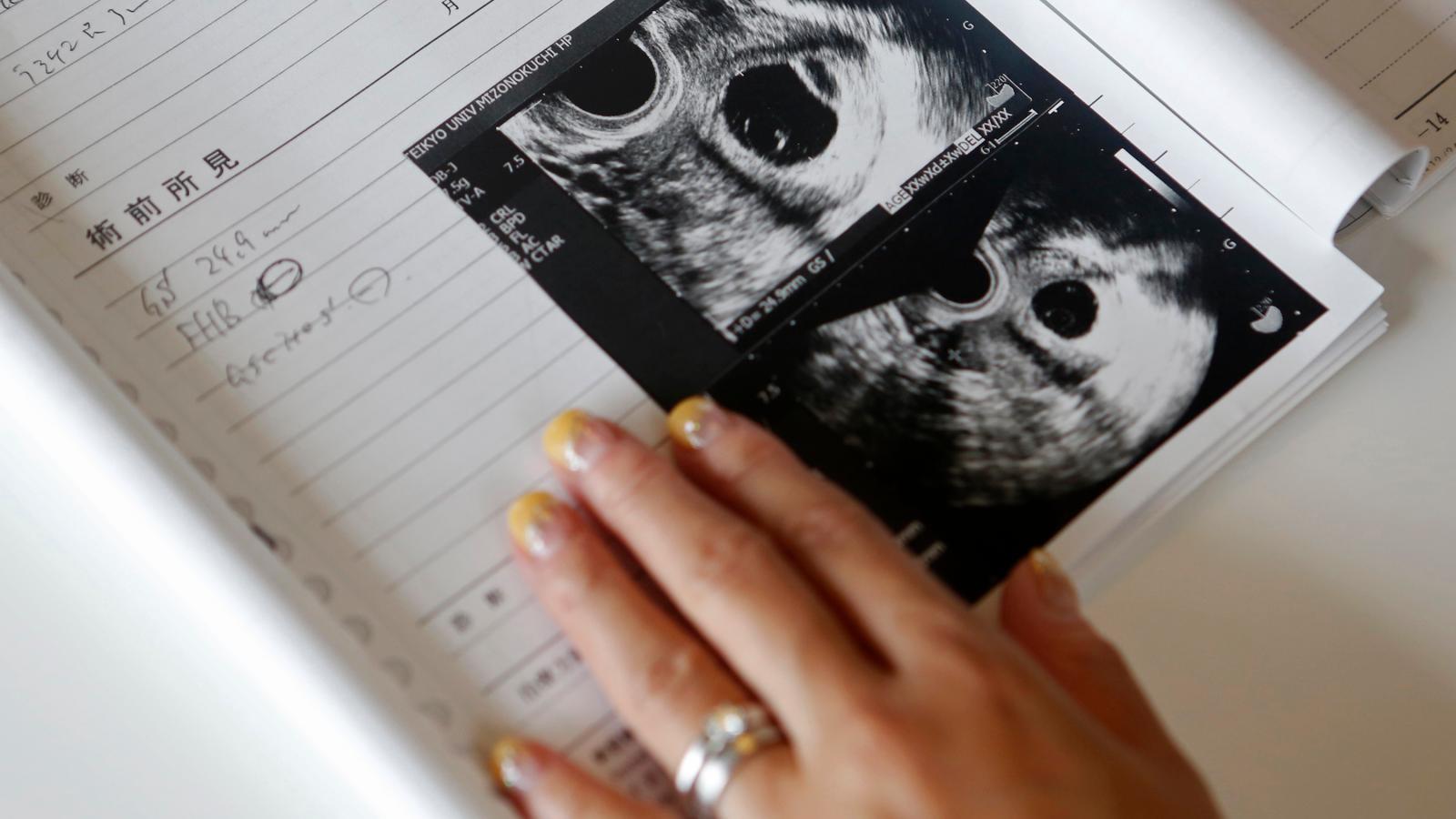 Ultrasound Wallpapers - Top Free Ultrasound Backgrounds - WallpaperAccess