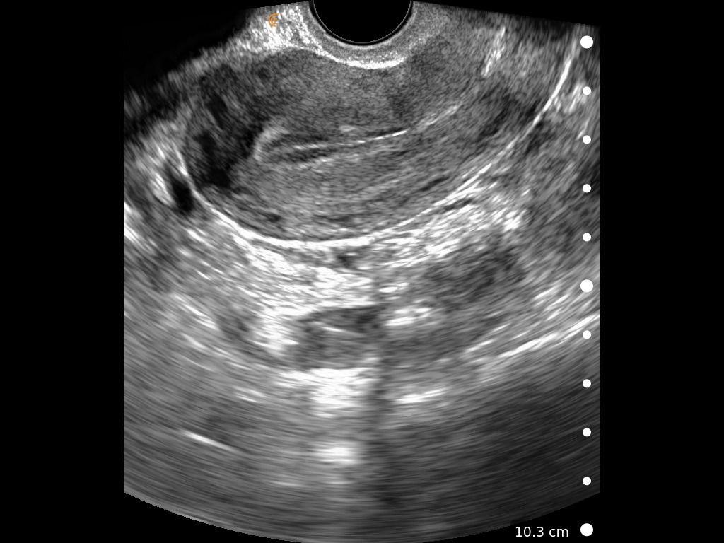 Ultrasound Wallpapers - Top Free Ultrasound Backgrounds - WallpaperAccess