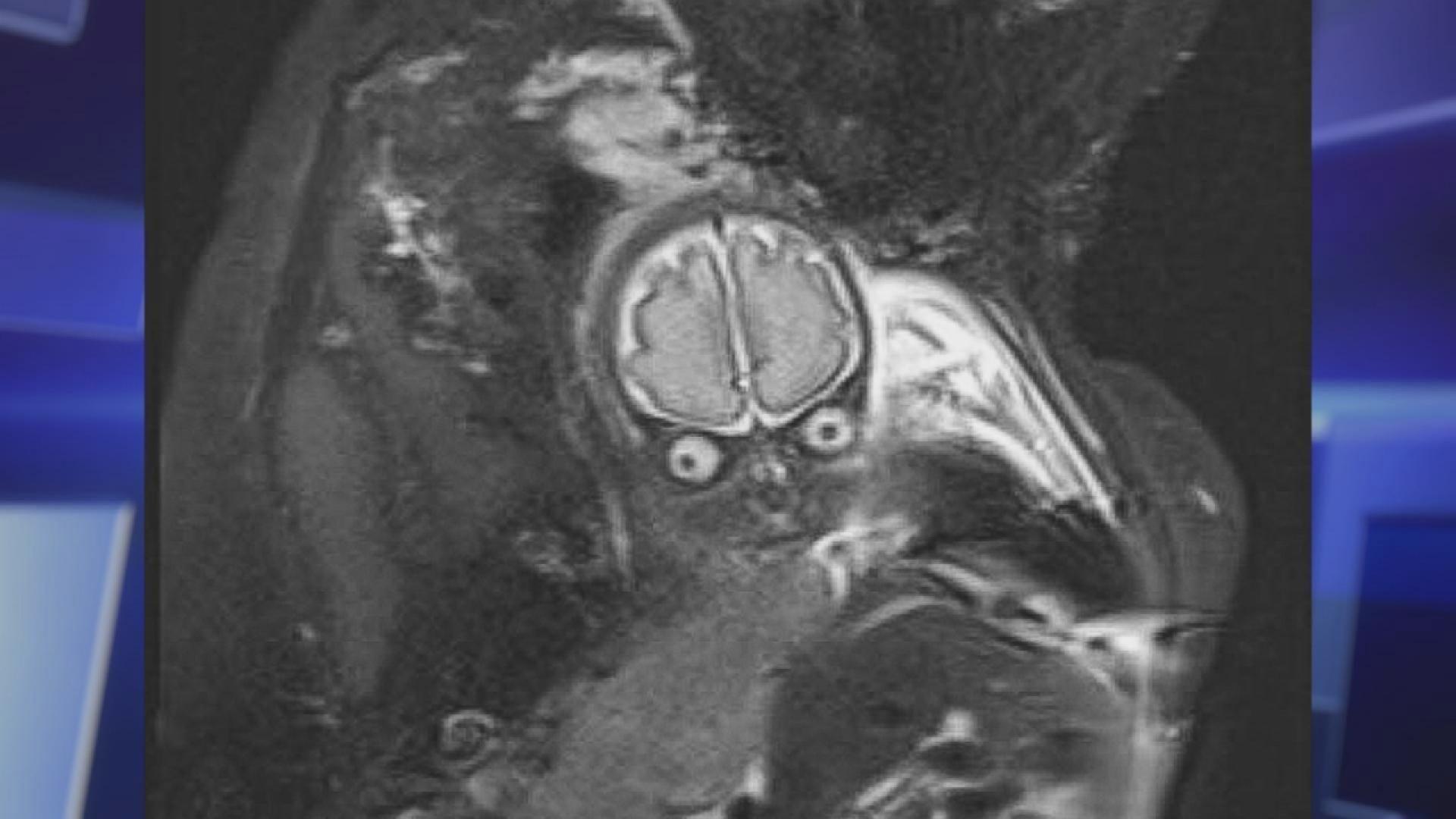 Ultrasound Wallpapers - Top Free Ultrasound Backgrounds - WallpaperAccess