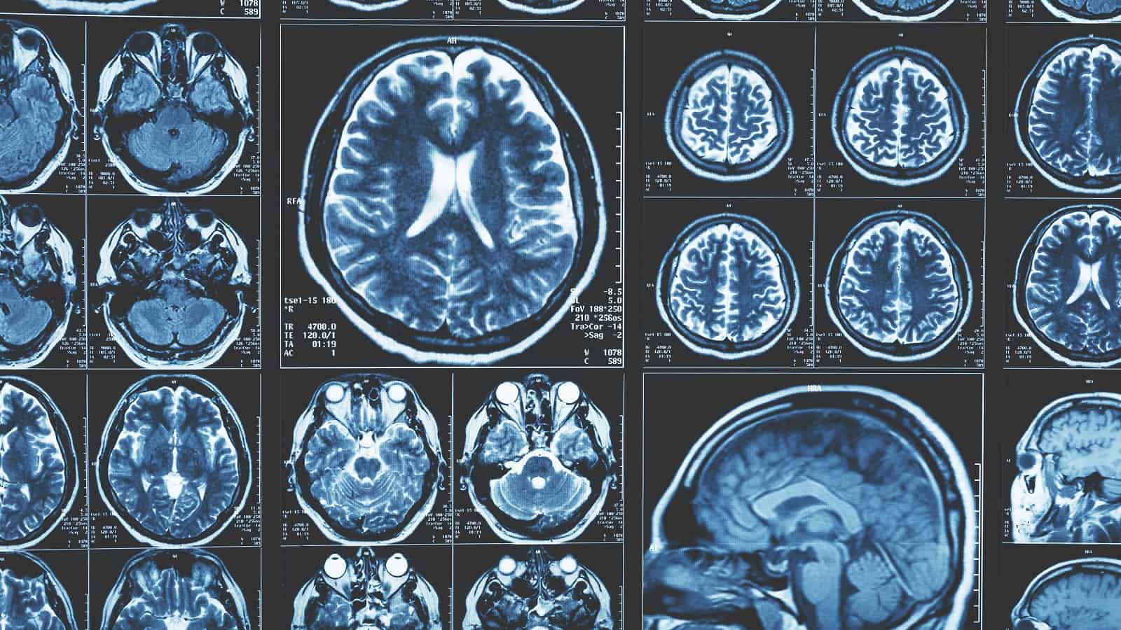 Artificial Intelligence Brain Wallpapers - Top Free Artificial ...