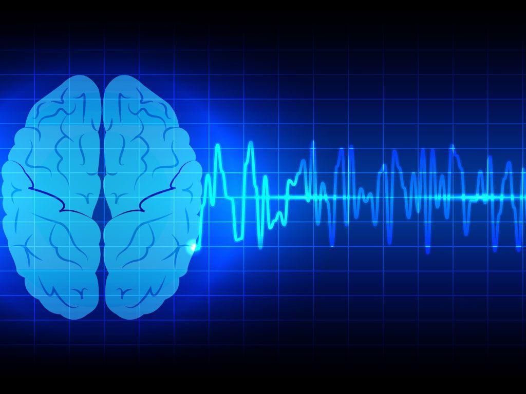 Neuro Wallpapers - Top Free Neuro Backgrounds - WallpaperAccess