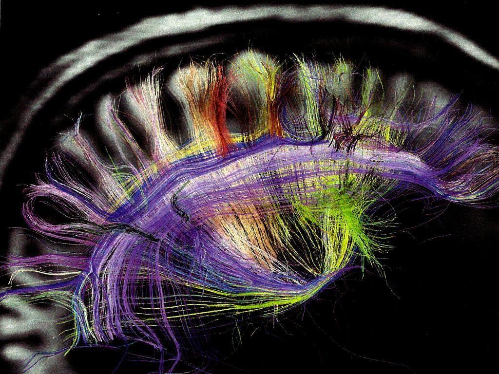 Brain Neuron Wallpapers - Top Free Brain Neuron Backgrounds ...