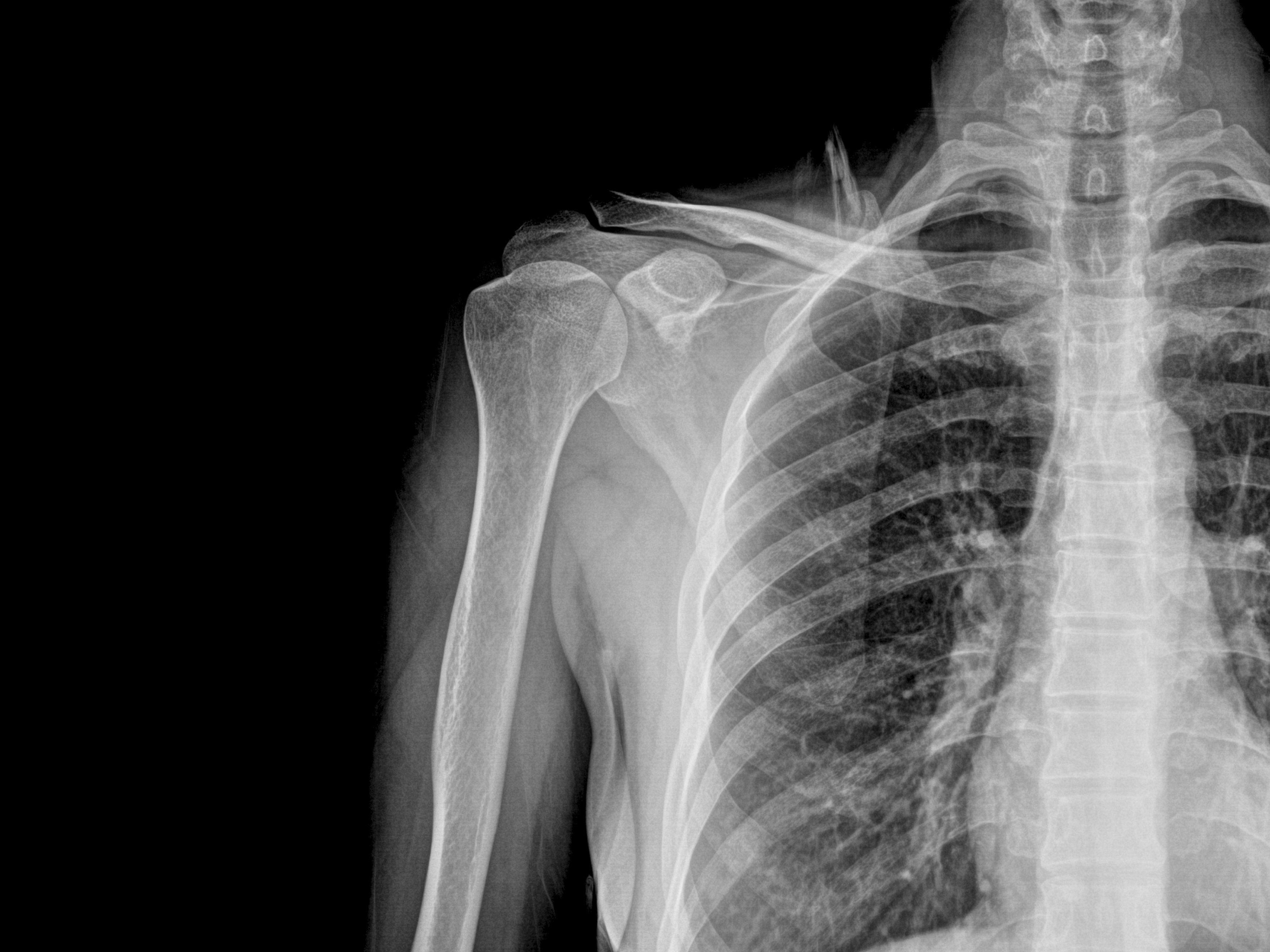 Radiography Wallpapers - Top Free Radiography Backgrounds - WallpaperAccess