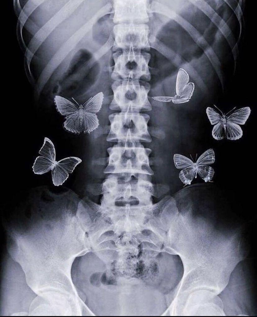 Radiography Wallpapers - Top Free Radiography Backgrounds - WallpaperAccess