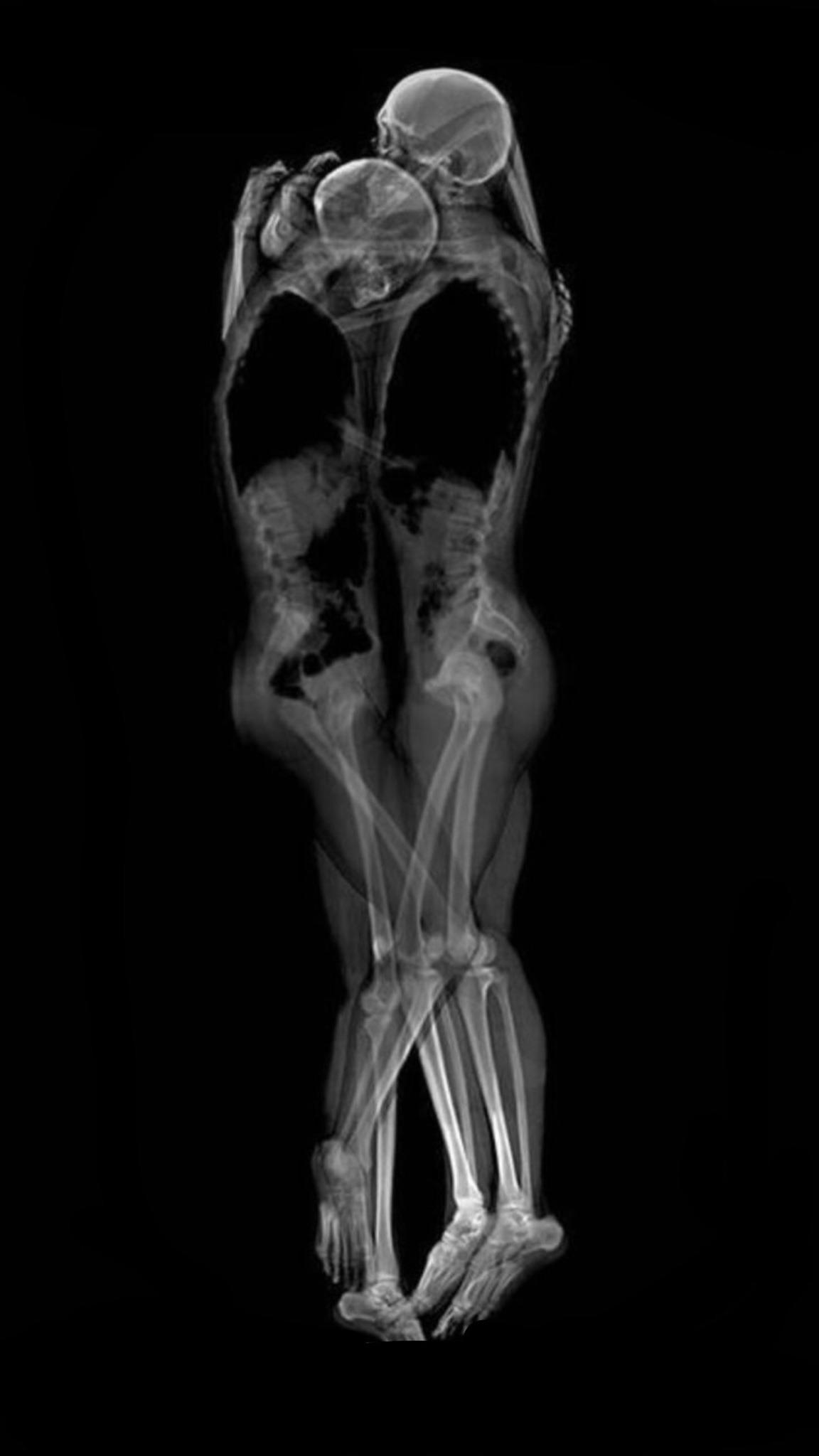 Radiologic Technologist Wallpapers - Top Free Radiologic Technologist ...