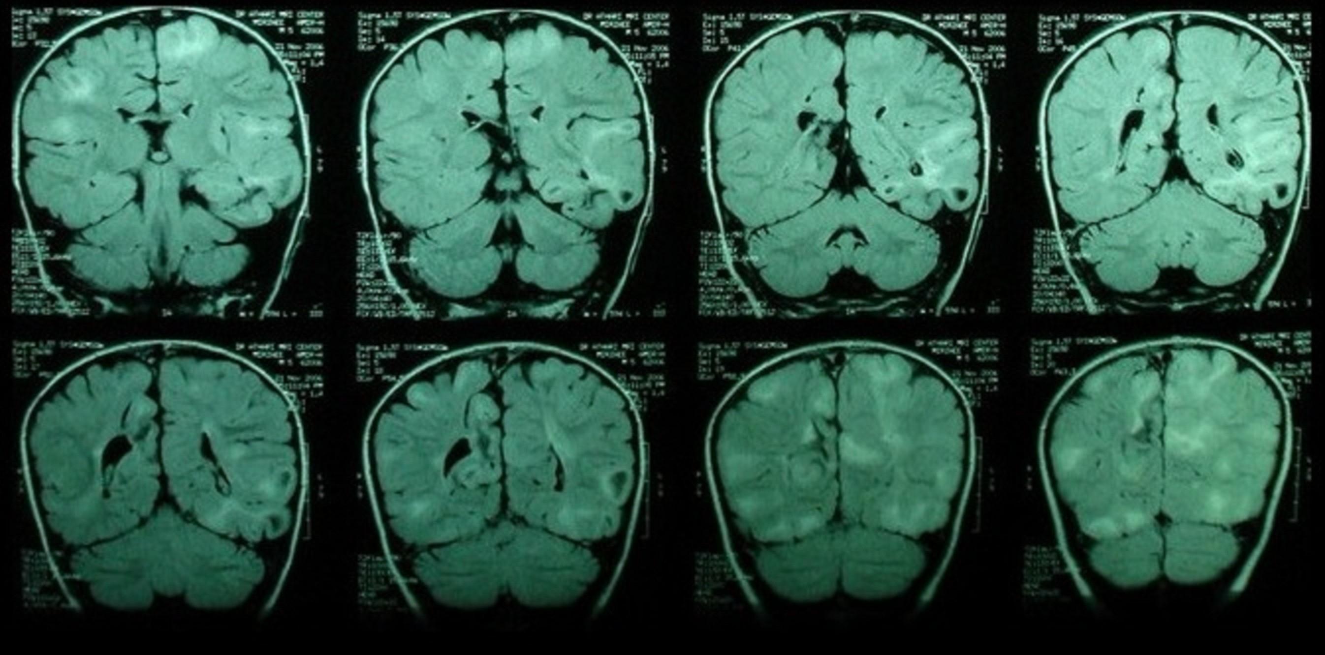 MRI Wallpapers - Top Free MRI Backgrounds - WallpaperAccess