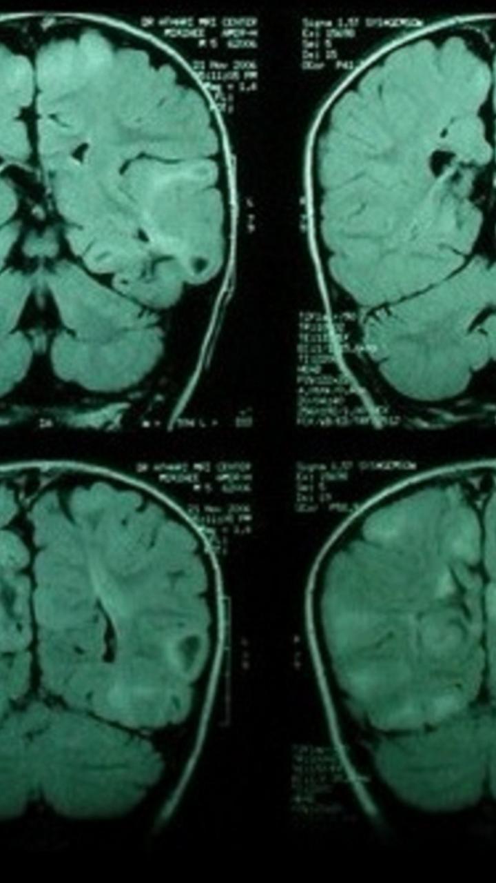 MRI Wallpapers - Top Free MRI Backgrounds - WallpaperAccess