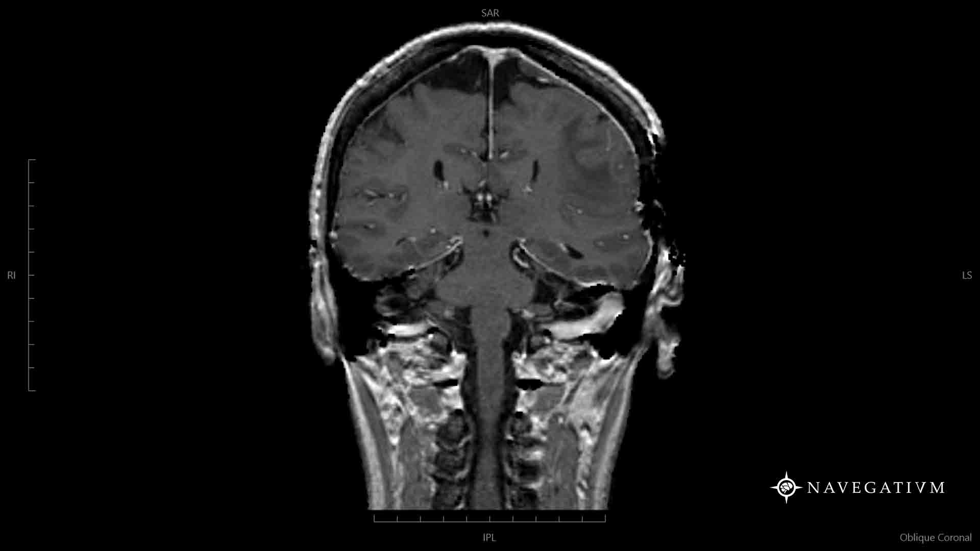 MRI Wallpapers - Top Free MRI Backgrounds - WallpaperAccess