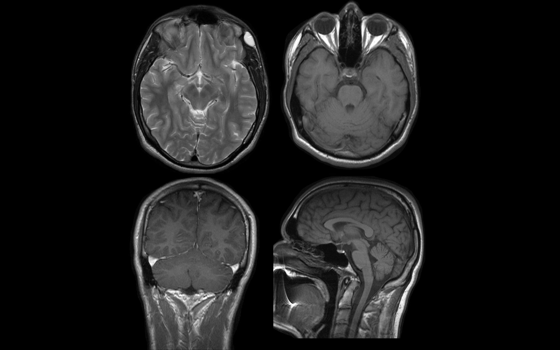 MRI Wallpapers - Top Free MRI Backgrounds - WallpaperAccess