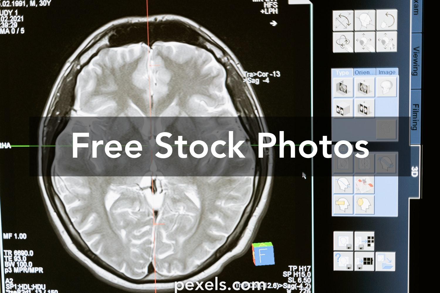 MRI Wallpapers - Top Free MRI Backgrounds - WallpaperAccess