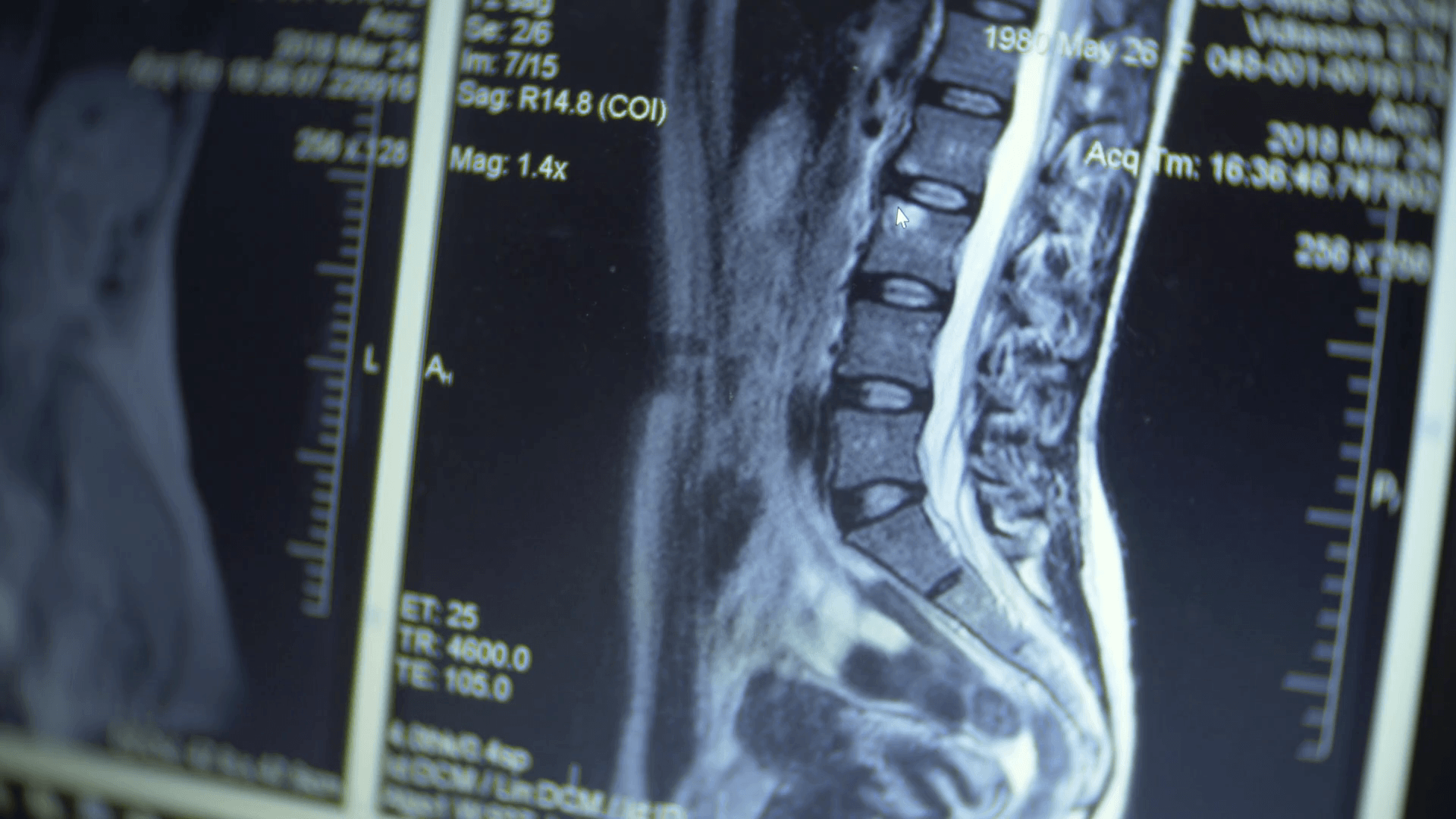 MRI Wallpapers - Top Free MRI Backgrounds - WallpaperAccess