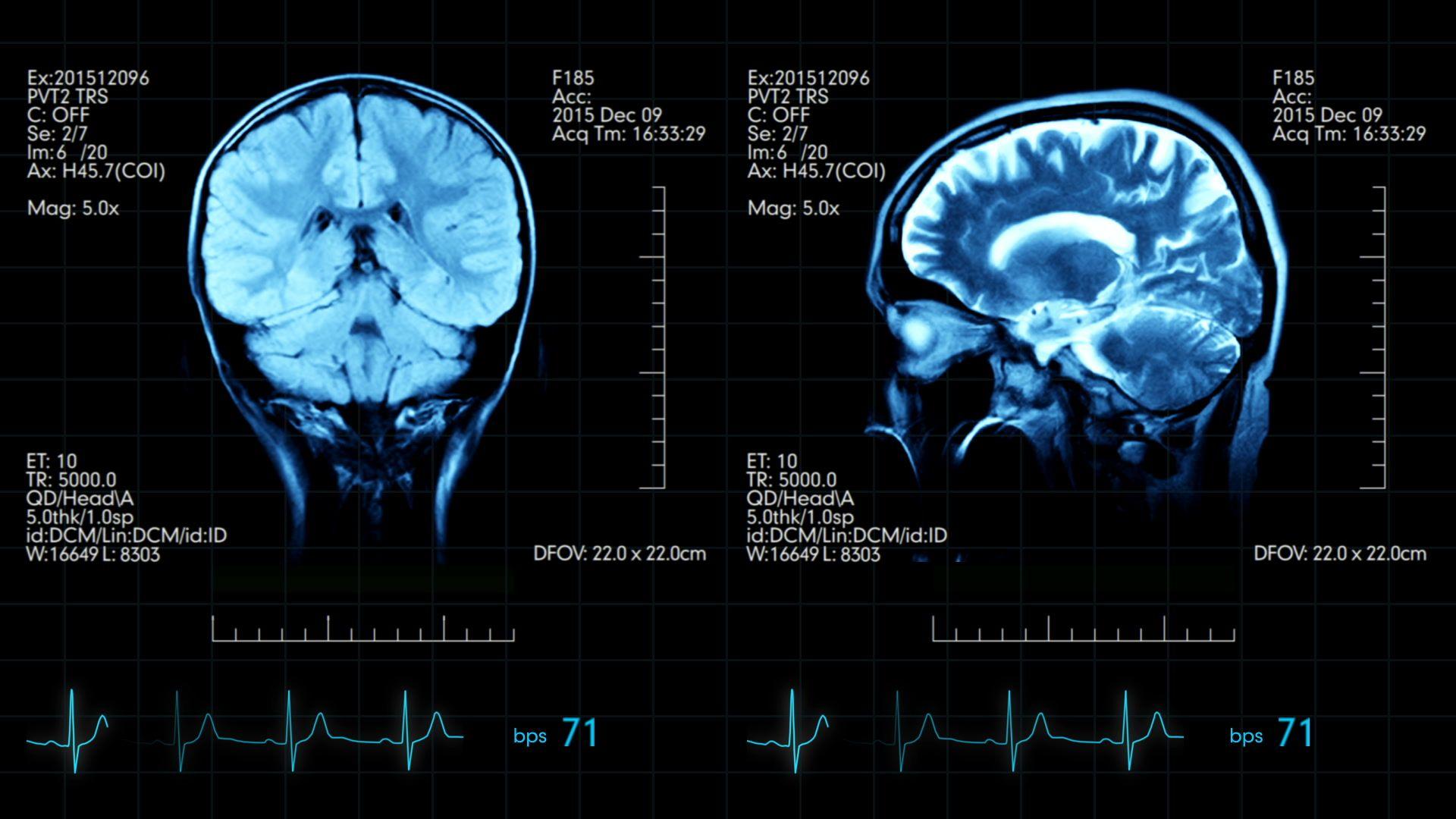 MRI Wallpapers - Top Free MRI Backgrounds - WallpaperAccess