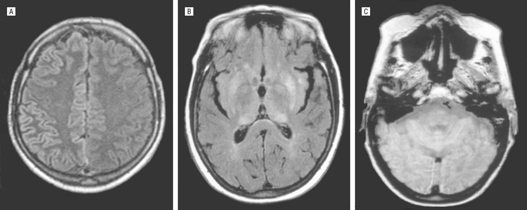 MRI Wallpapers - Top Free MRI Backgrounds - WallpaperAccess