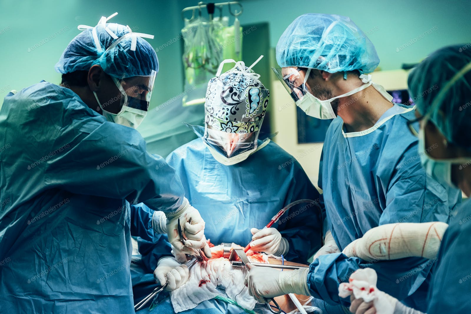 Surgery HD Wallpapers - Top Free Surgery HD Backgrounds - WallpaperAccess
